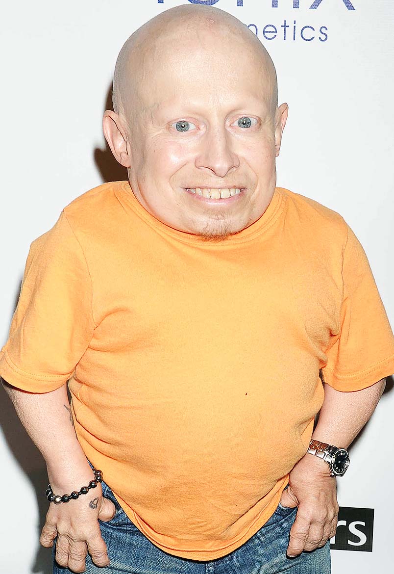 Verne Troyer Suffers Seizure, Is Doing Okay - TV Guide